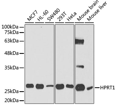 HPRT1 Antibody, KO Validated - Cat. No. 19-798 | ProSci