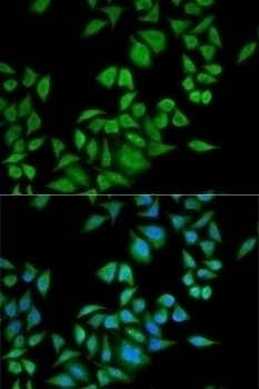 QDPR Antibody - Cat. No. 19-822 | ProSci