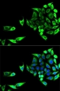 GOT1 Antibody - Cat. No. 19-881 | ProSci