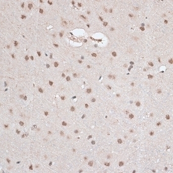 RBM3 Antibody - Cat. No. 19-949 | ProSci