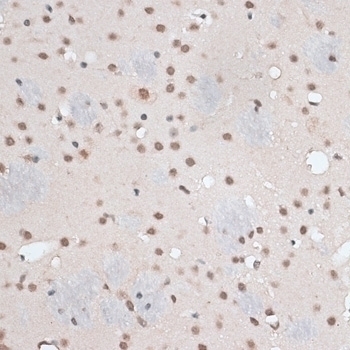 RBM3 Antibody - Cat. No. 19-949 | ProSci