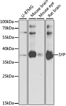 SYP Antibody - Cat. No. 22-143 | ProSci