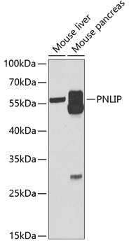 PNLIP Antibody - Cat. No. 22-186 | ProSci
