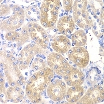 PNLIP Antibody - Cat. No. 22-186 | ProSci