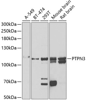PTPN3 Antibody - Cat. No. 22-190 | ProSci