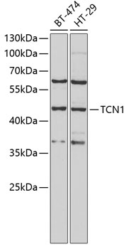 TCN1 Antibody - Cat. No. 22-203 | ProSci