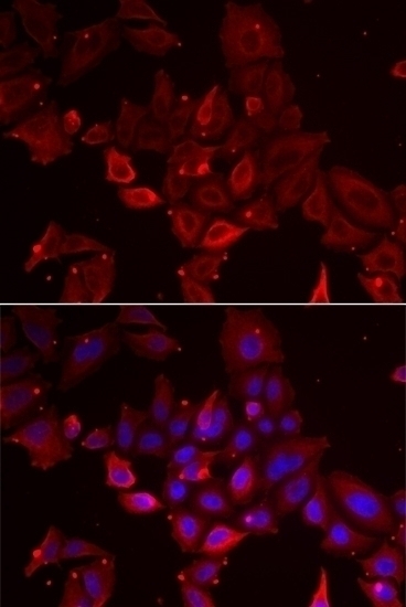 MYOT Antibody - Cat. No. 22-222 | ProSci
