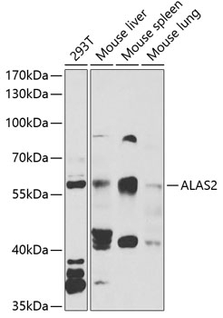 ALAS2 Antibody - Cat. No. 22-284 | ProSci