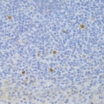 FCN1 Antibody - Cat. No. 22-334 | ProSci