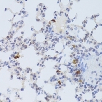 FCN1 Antibody - Cat. No. 22-334 | ProSci