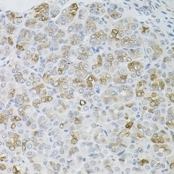 HPS1 Antibody - Cat. No. 22-358 | ProSci