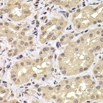 PSMD12 Antibody - Cat. No. 22-424 | ProSci