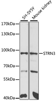 STRN3 Antibody - Cat. No. 22-464 | ProSci