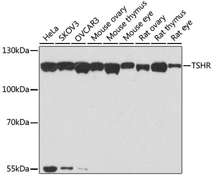 TSHR Antibody - Cat. No. 22-481 | ProSci