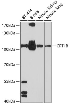 CPT1B Antibody - Cat. No. 22-492 | ProSci