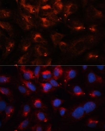 CPT1B Antibody - Cat. No. 22-492 | ProSci