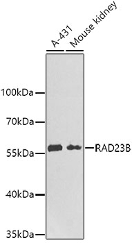 RAD23B Antibody [D5D3] - Cat. No. 22-506 | ProSci