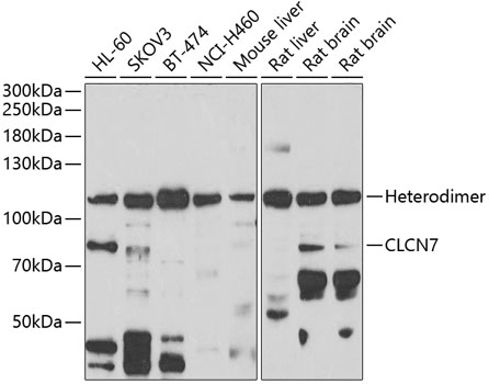 CLCN7 Antibody - Cat. No. 22-531 | ProSci