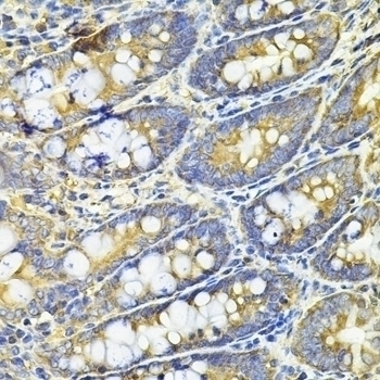 HPGD Antibody - Cat. No. 22-560 | ProSci