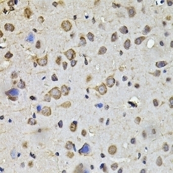 HPGD Antibody - Cat. No. 22-560 | ProSci