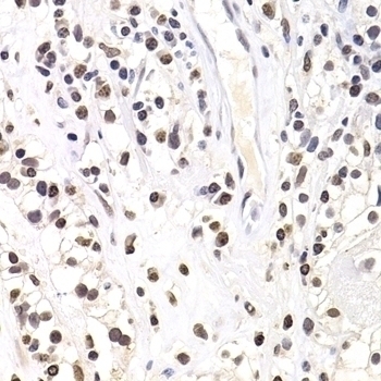 SOX5 Antibody - Cat. No. 22-607 | ProSci