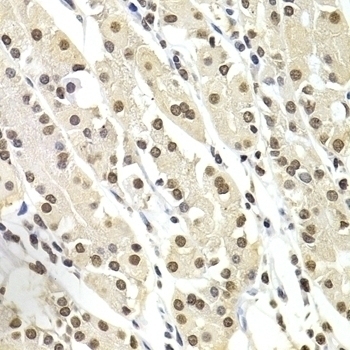 SOX5 Antibody - Cat. No. 22-607 | ProSci