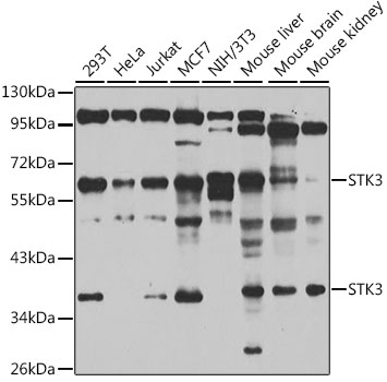 STK3 Antibody - Cat. No. 22-614 | ProSci