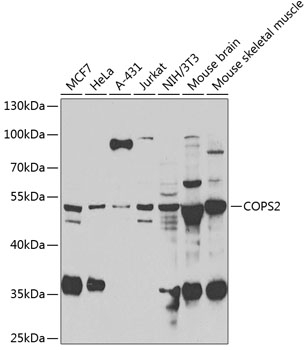 COPS2 Antibody - Cat. No. 22-649 | ProSci