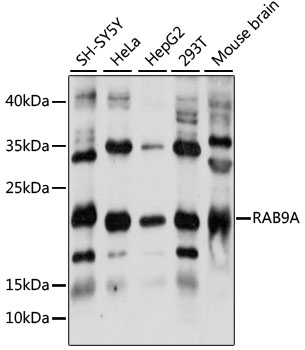 RAB9A Antibody - Cat. No. 22-652 | ProSci