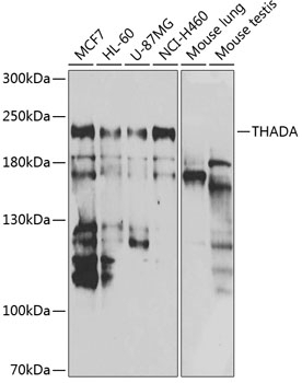 THADA Antibody - Cat. No. 22-725 | ProSci