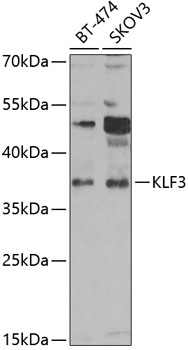 KLF3 Antibody - Cat. No. 22-773 | ProSci