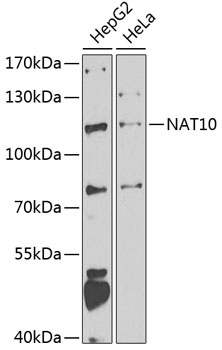 NAT10 Antibody - Cat. No. 22-840 | ProSci