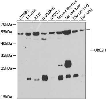 UBE2H Antibody - Cat. No. 22-879 | ProSci