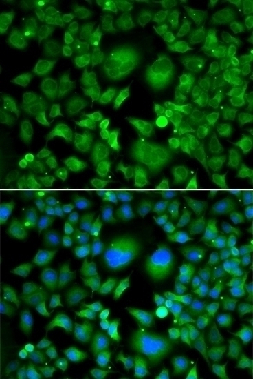 UBE2H Antibody - Cat. No. 22-879 | ProSci