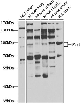 IWS1 Antibody - Cat. No. 22-899 | ProSci