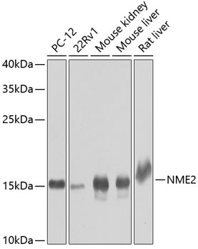 NME2 Antibody - Cat. No. 22-943 | ProSci