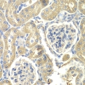 OAZ1 Antibody - Cat. No. 22-944 | ProSci