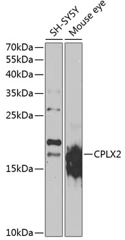 CPLX2 Antibody - Cat. No. 23-175 | ProSci