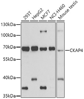 CKAP4 Antibody - Cat. No. 23-178 | ProSci