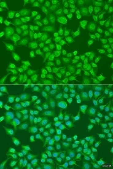 ACOX1 Antibody - Cat. No. 23-395 | ProSci