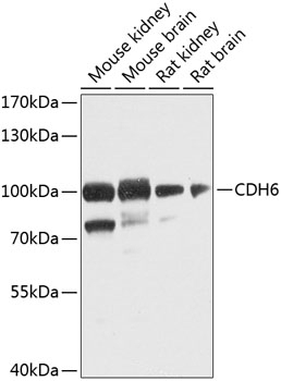 CDH6 Antibody - Cat. No. 23-406 | ProSci