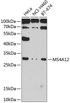 MS4A12 Antibody - Cat. No. 23-468 | ProSci