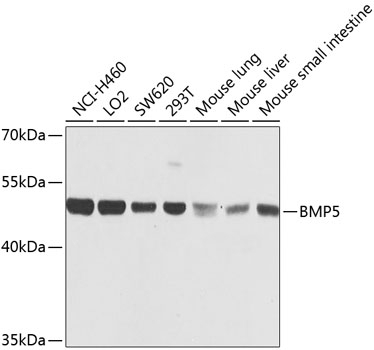 BMP5 Antibody - Cat. No. 23-558 | ProSci