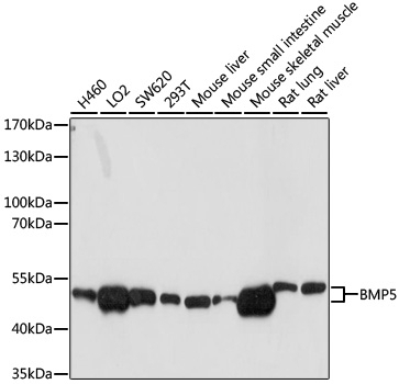 BMP5 Antibody - Cat. No. 23-558 | ProSci