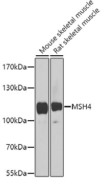 MSH4 Antibody - Cat. No. 23-657 | ProSci