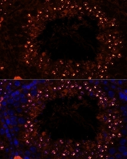 MSH4 Antibody - Cat. No. 23-657 | ProSci