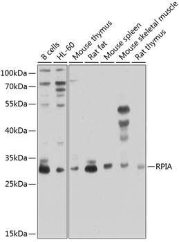 RPIA Antibody - Cat. No. 23-747 | ProSci