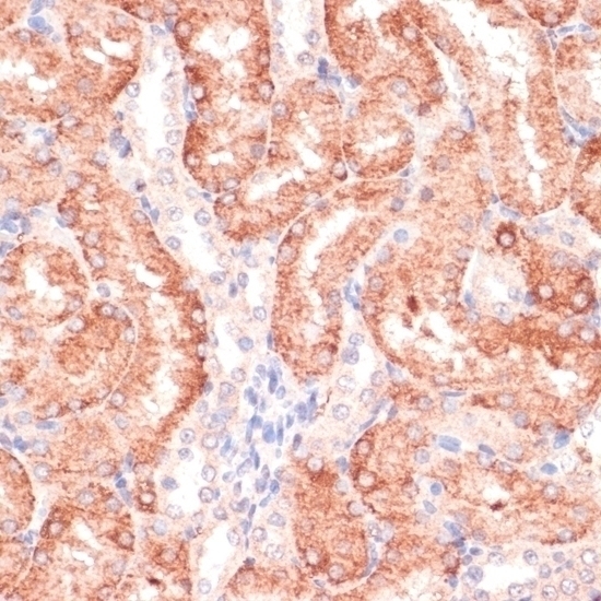 RPIA Antibody - Cat. No. 23-747 | ProSci