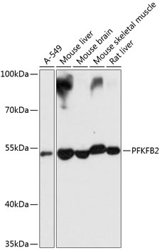 PFKFB2 Antibody - Cat. No. 23-840 | ProSci