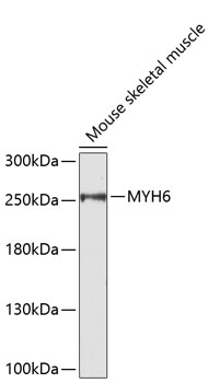 MYH6 Antibody - Cat. No. 23-876 | ProSci